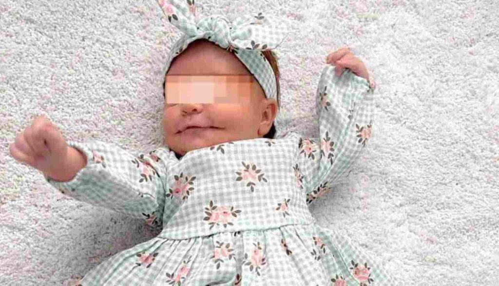 La condizione fisica è rara ma la bimba diventa star da 46 milioni di click