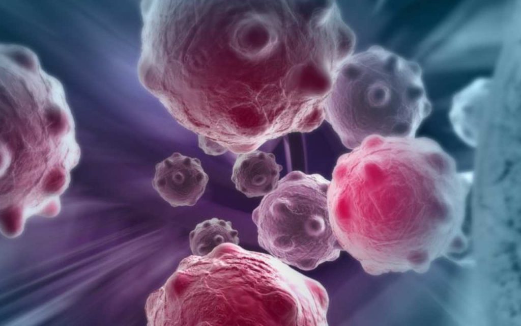 Un test genetico può prevenire il tumore